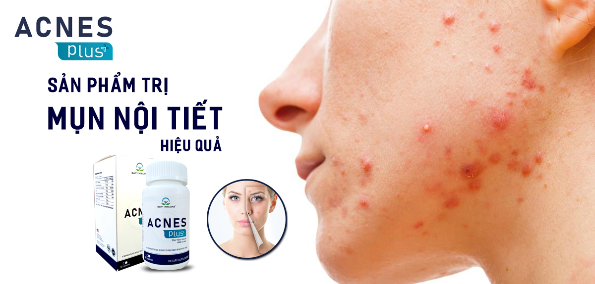 Viên uống trị mụn nội tiết tốt nhất 2024